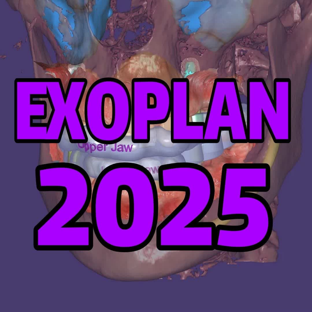 ExoPlan 3.1 - 2025 | اگزوپلن 2025 - گلد اپ